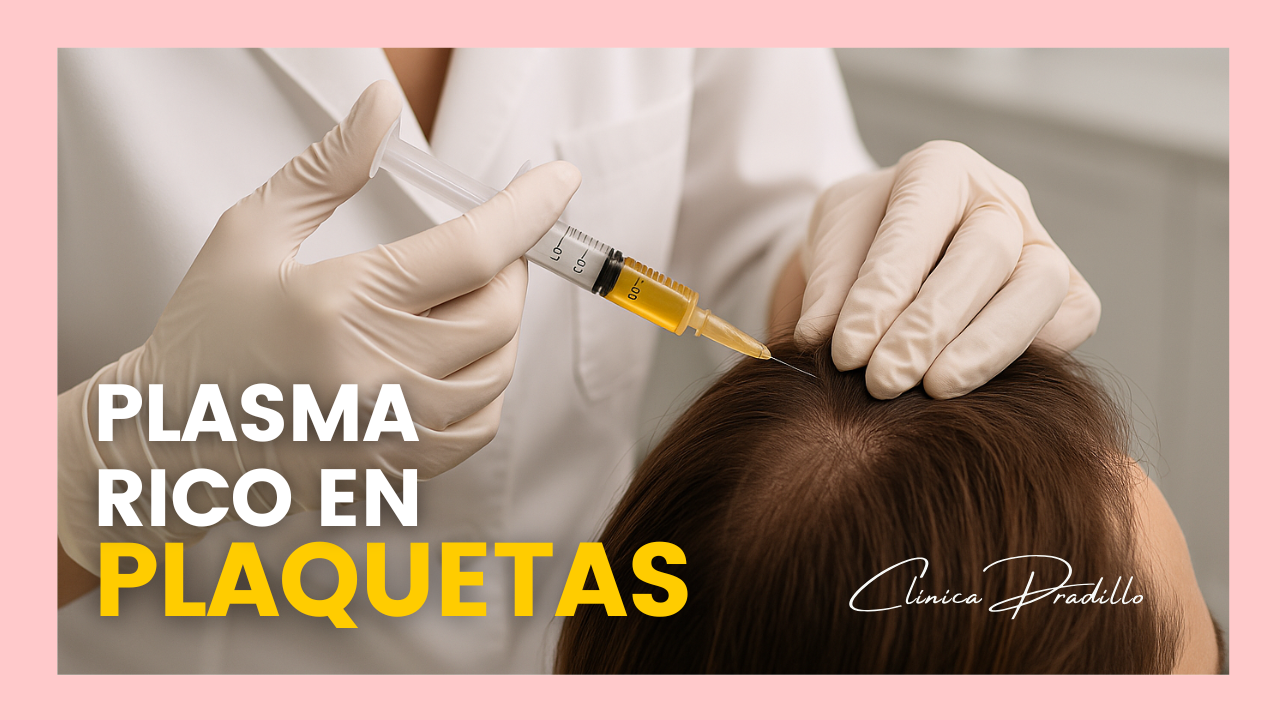 Plasma Rico en Plaquetas para tratamiento capilar